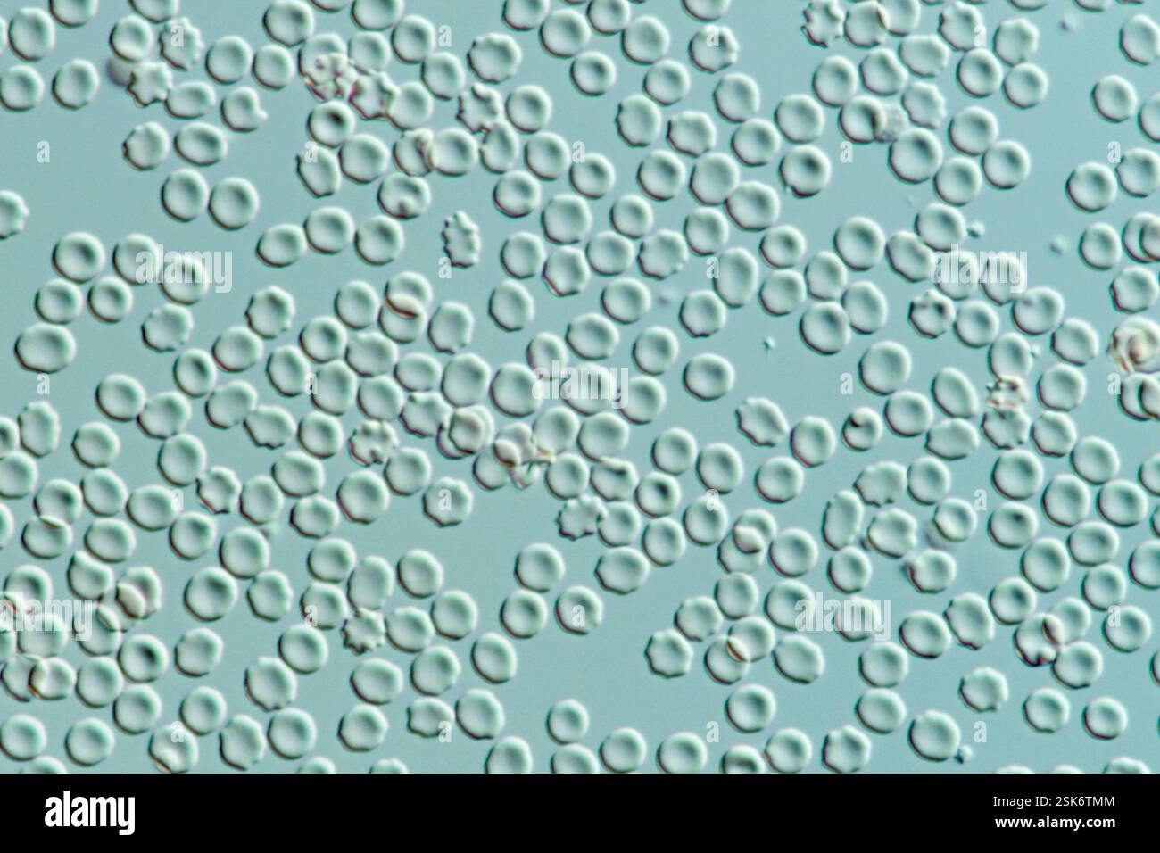 Isotonic red blood cells. Light micrograph of red blood cells in an ...