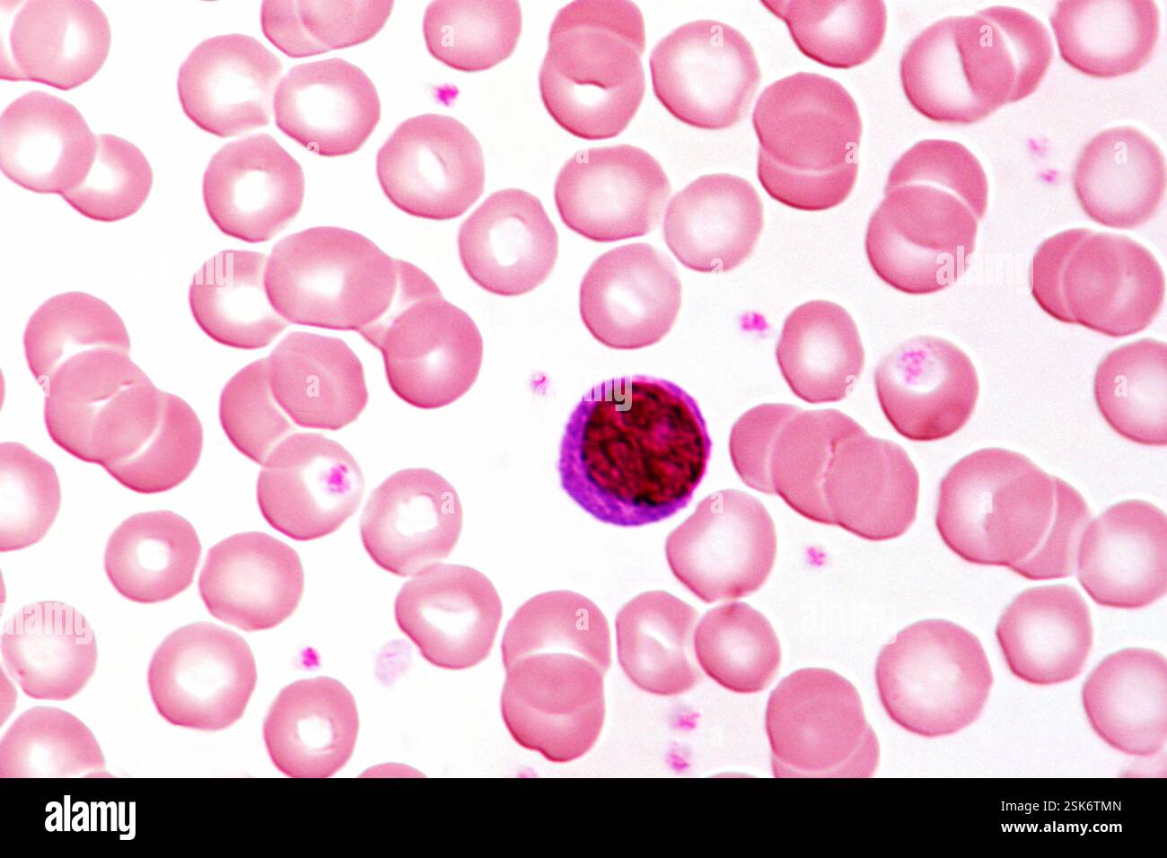Red blood cells, light micrograph Stock Photo - Alamy
