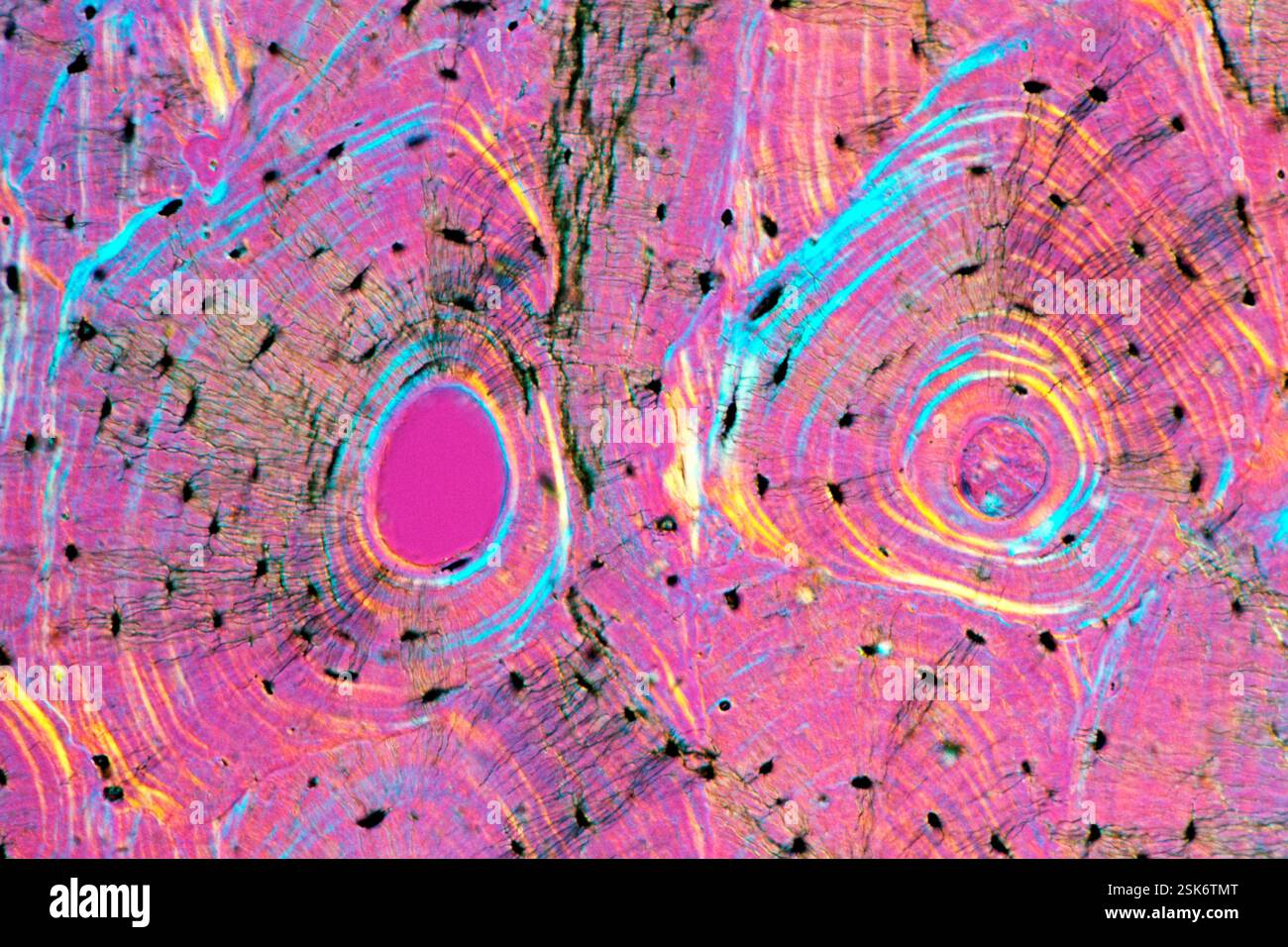 Bone canals. Polarized light micrograph of a cross-section through ...