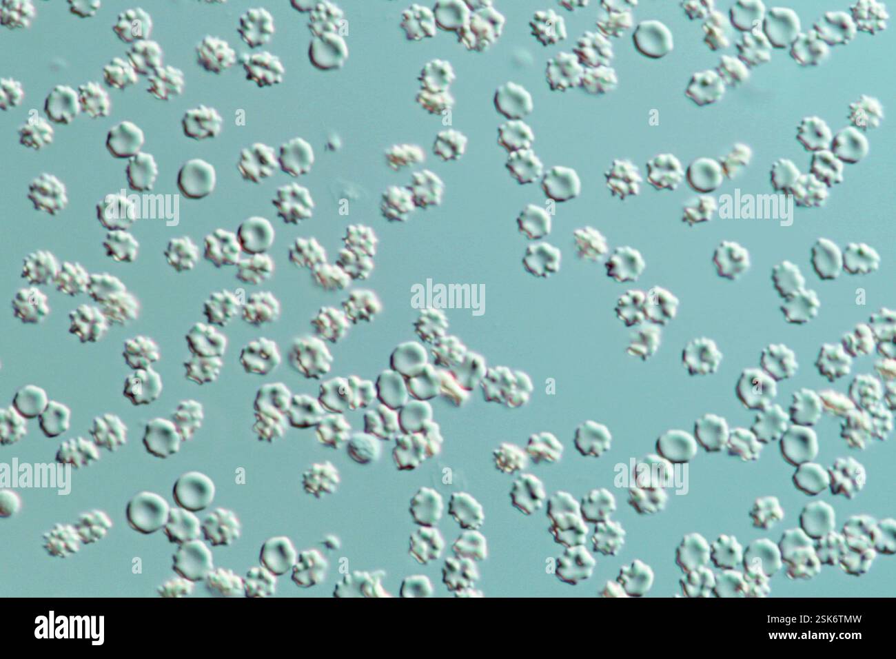 Hypertonic red blood cells. Light micrograph of red blood cells in a ...