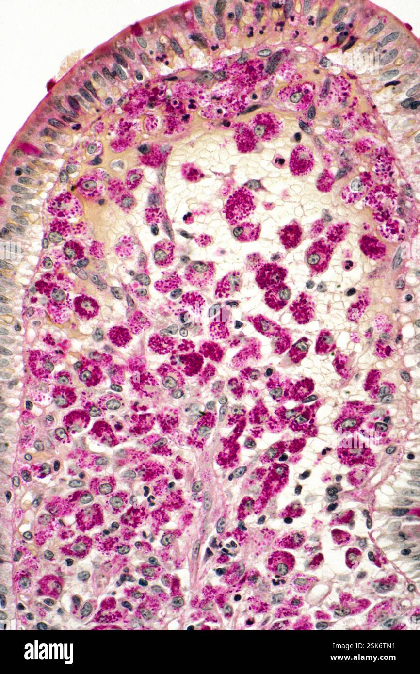 12 week old foetus, ultrasound scan Stock Photo - Alamy