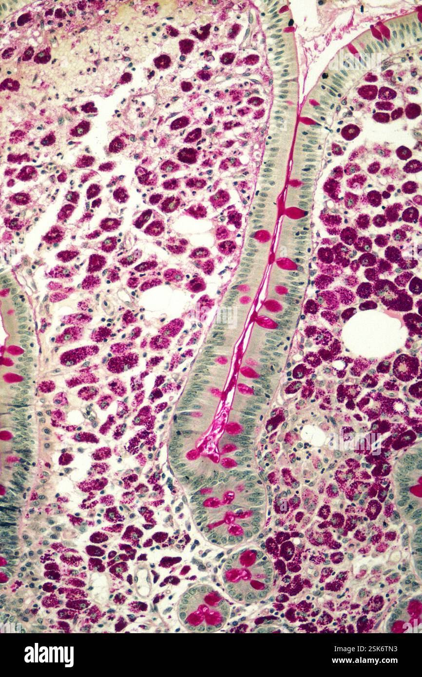 Twin foetuses, ultrasound scan Stock Photo - Alamy