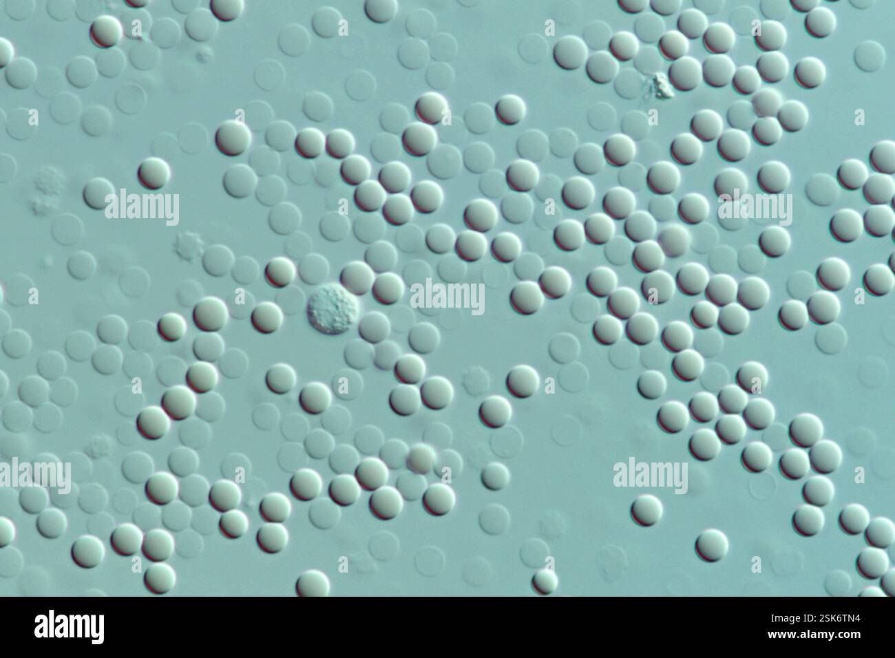 Hypotonic red blood cells. Light micrograph of red blood cells in a ...