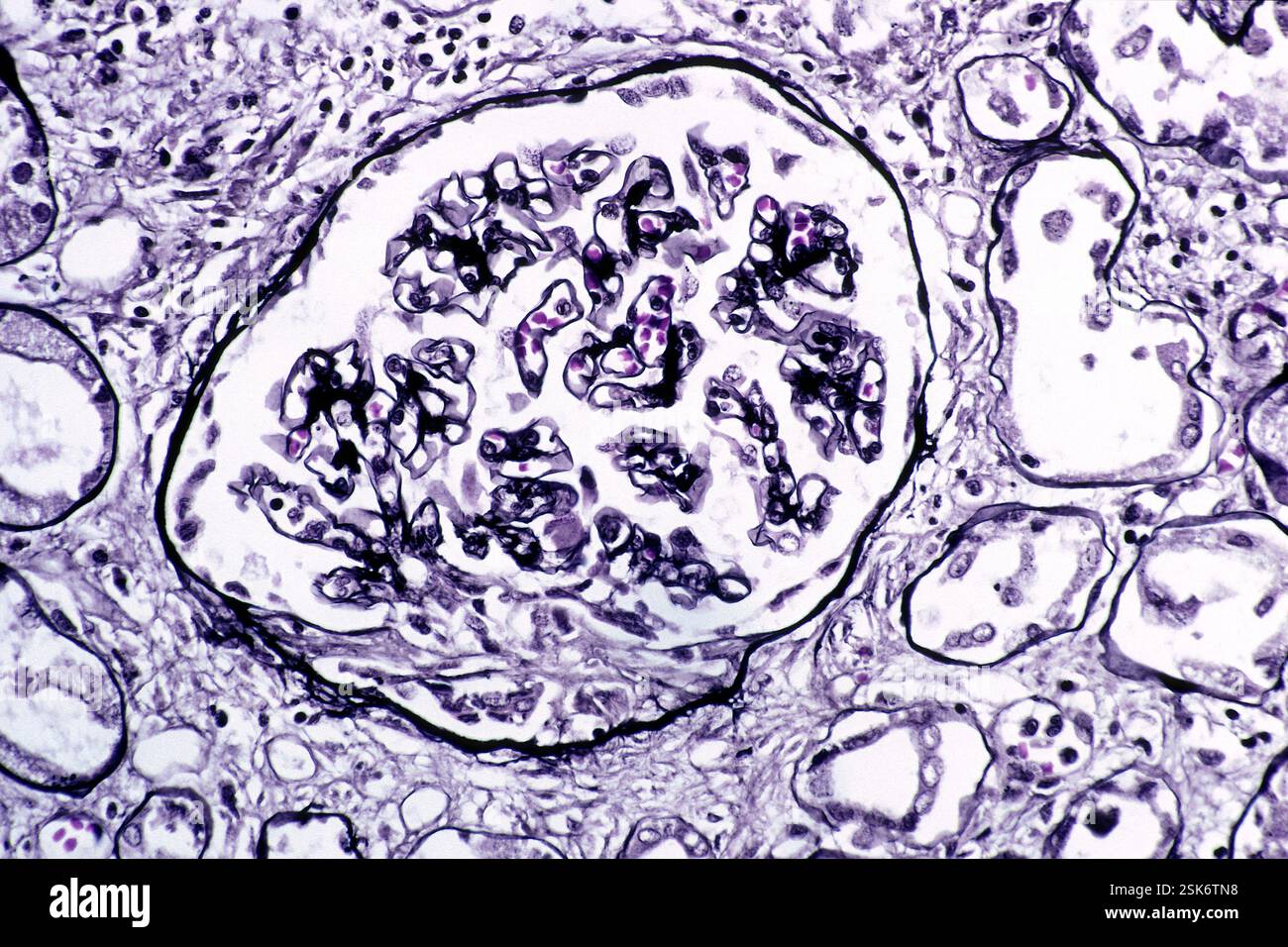Kidney glomerulus. Light microscope of a section through the cortex of ...