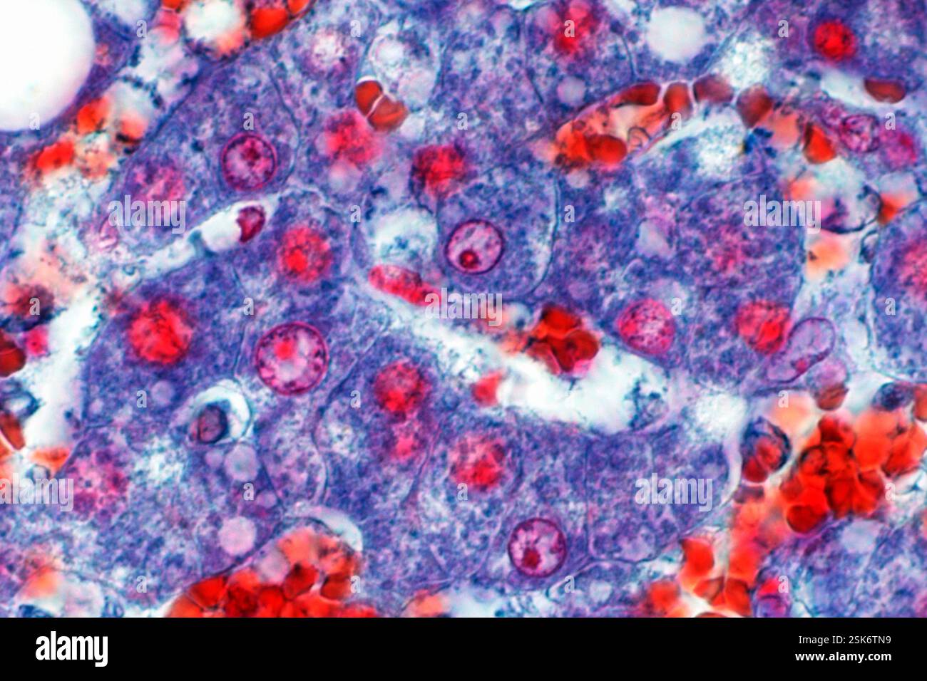 Liver cells, light micrograph Stock Photo - Alamy