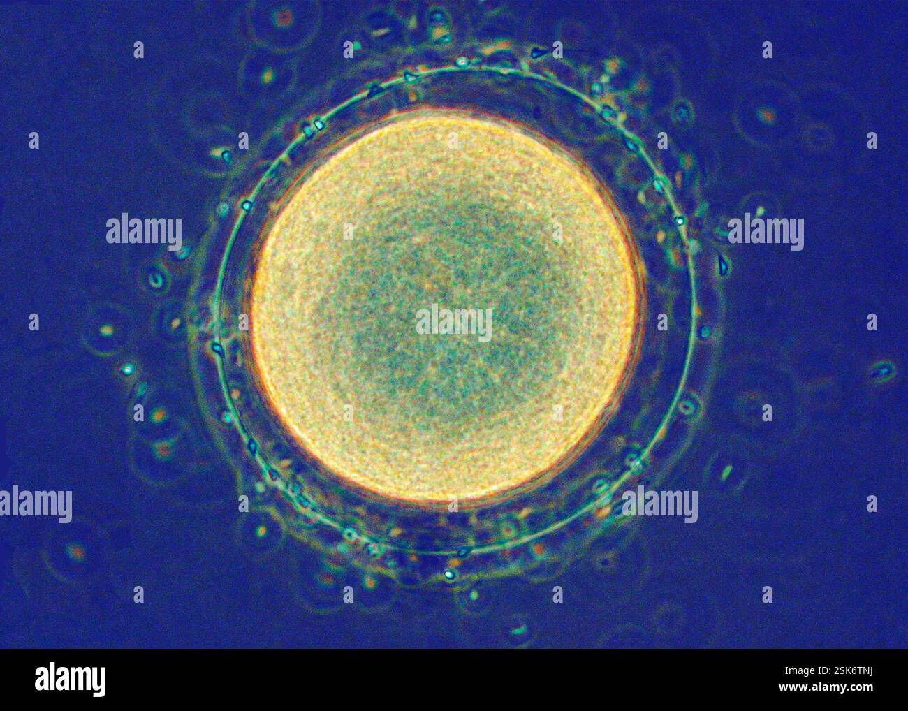 Fertilisation of a sea urchin egg, light micrograph. The female egg ...