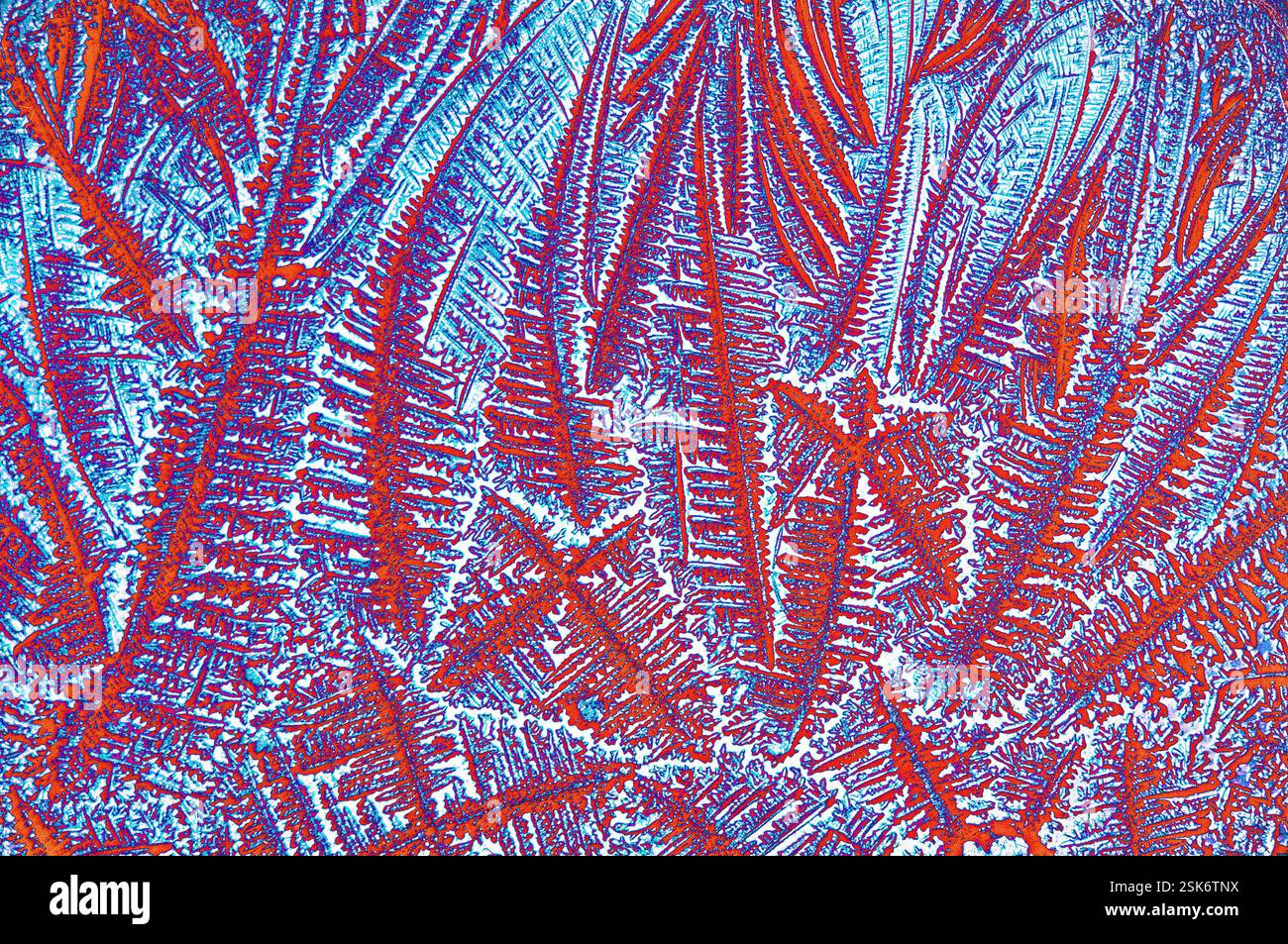 Cervical mucus. Light micrograph of cervical mucus around the period of ...