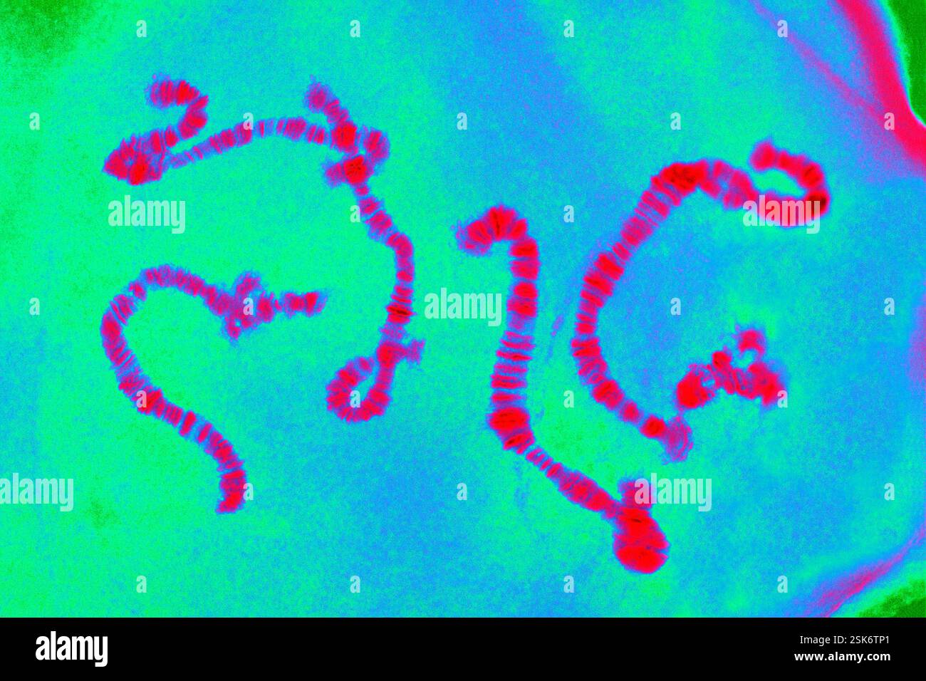Giant chromosomes. Light micrograph of giant (polytene) chromosomes ...