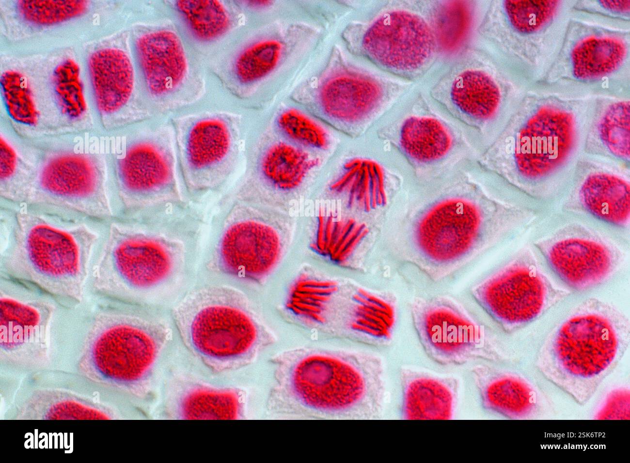 Mitosis. Light micrograph of hyacinth root cells undergoing mitosis ...