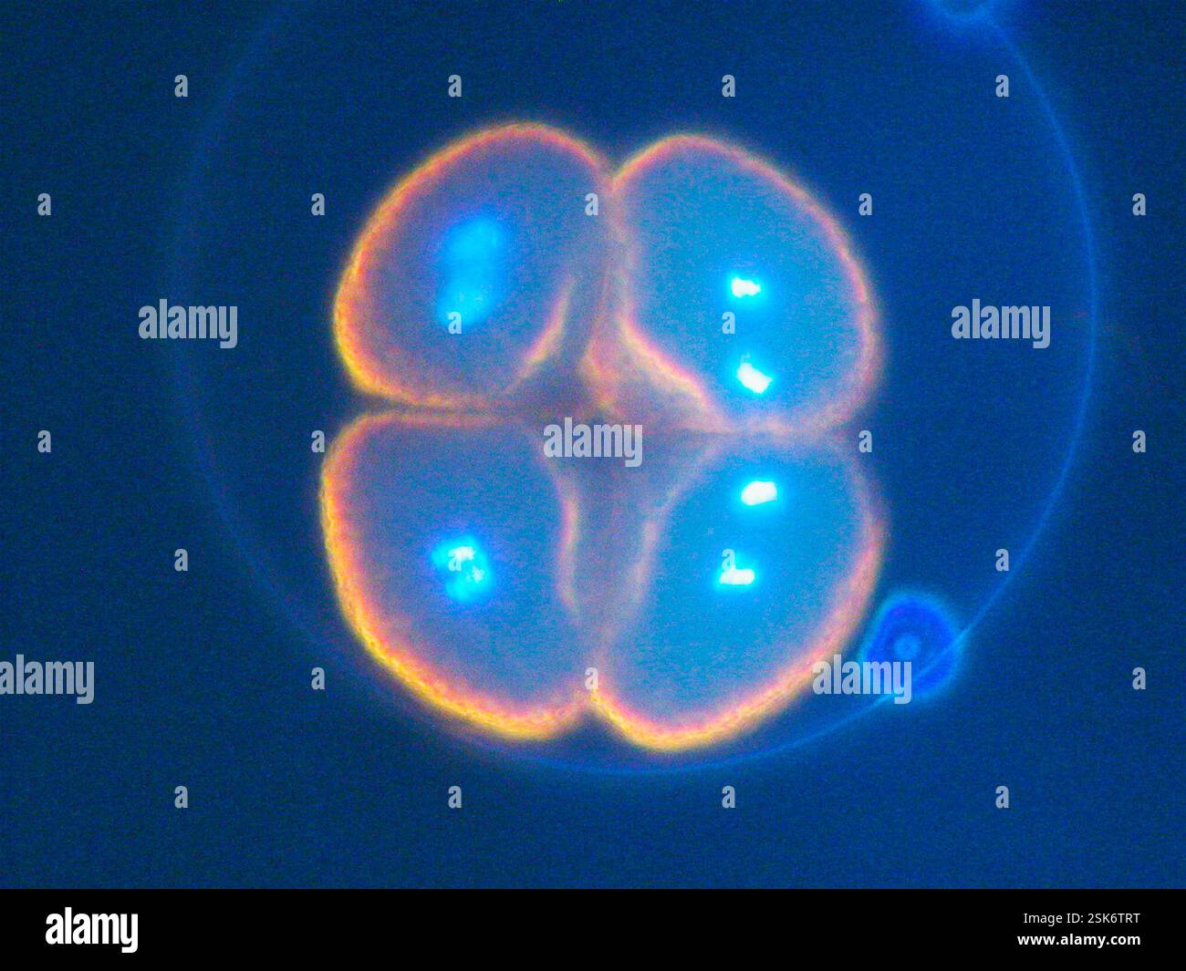 Sea urchin embryo, four-cell stage, light micrograph. These four ...