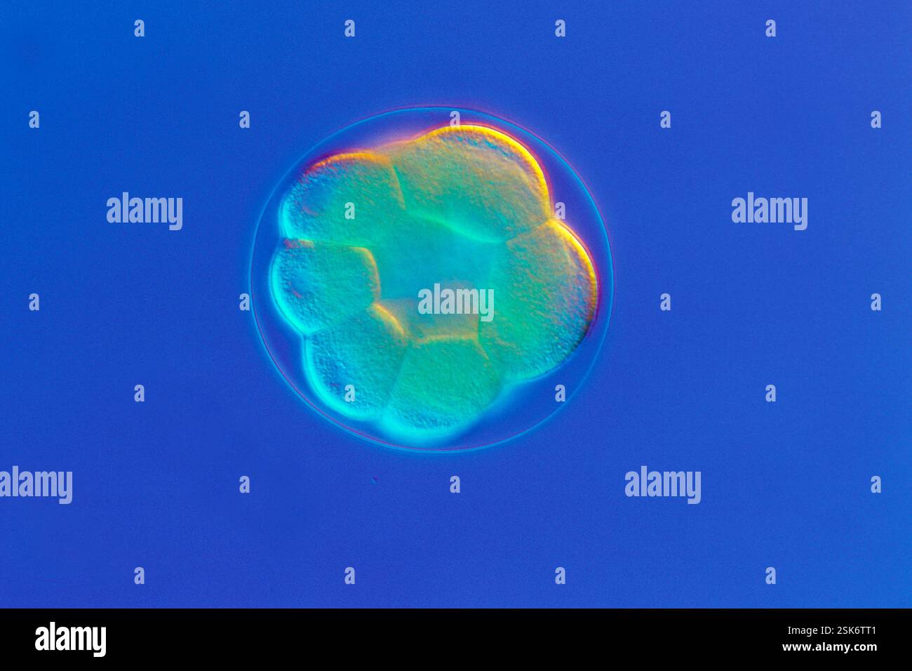 Sea urchin morula embryo, light microscope. Image 3 of 3. The morula is ...