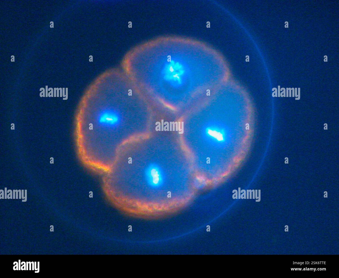 Sea urchin embryo, four-cell stage, light micrograph. These four ...