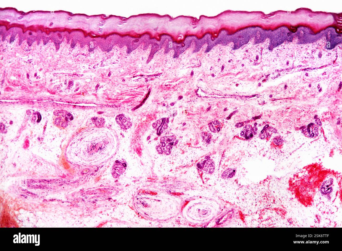 Skin layers, light micrograph Stock Photo - Alamy