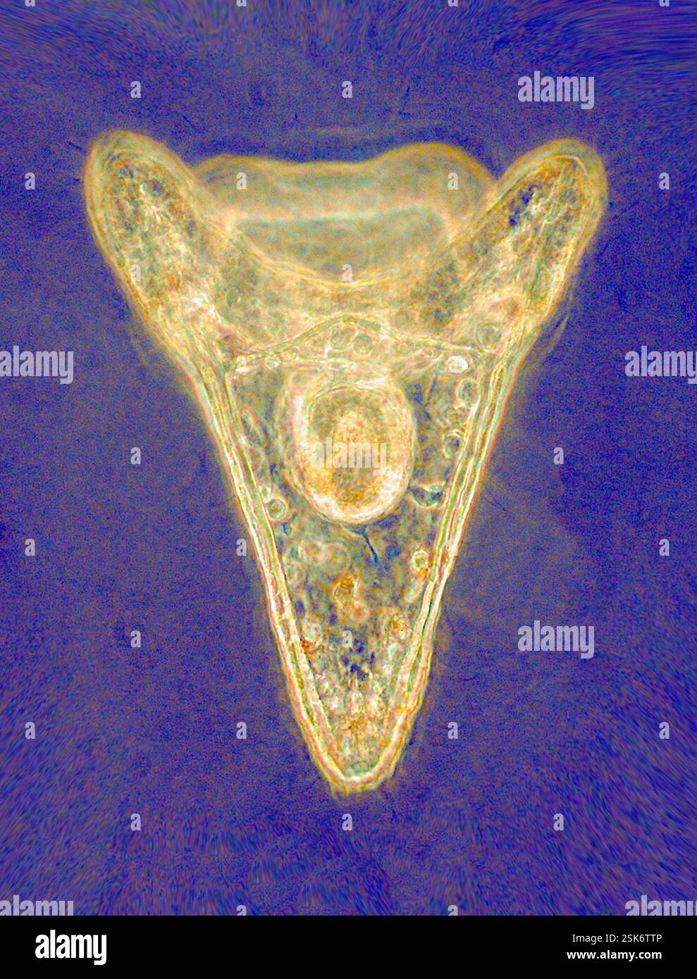 Sea urchin larva, light micrograph. This larval stage is known as a ...