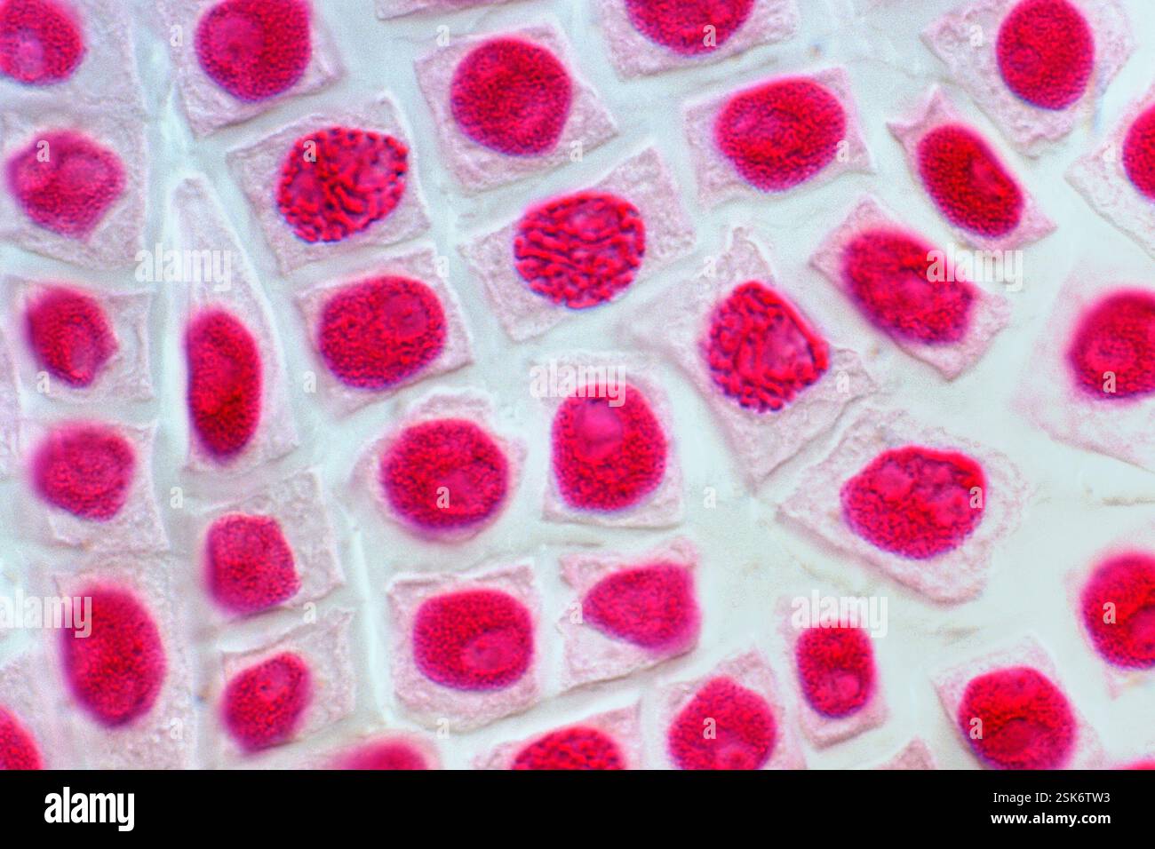 Mitosis. Light micrograph of hyacinth root cells in the initial stage ...