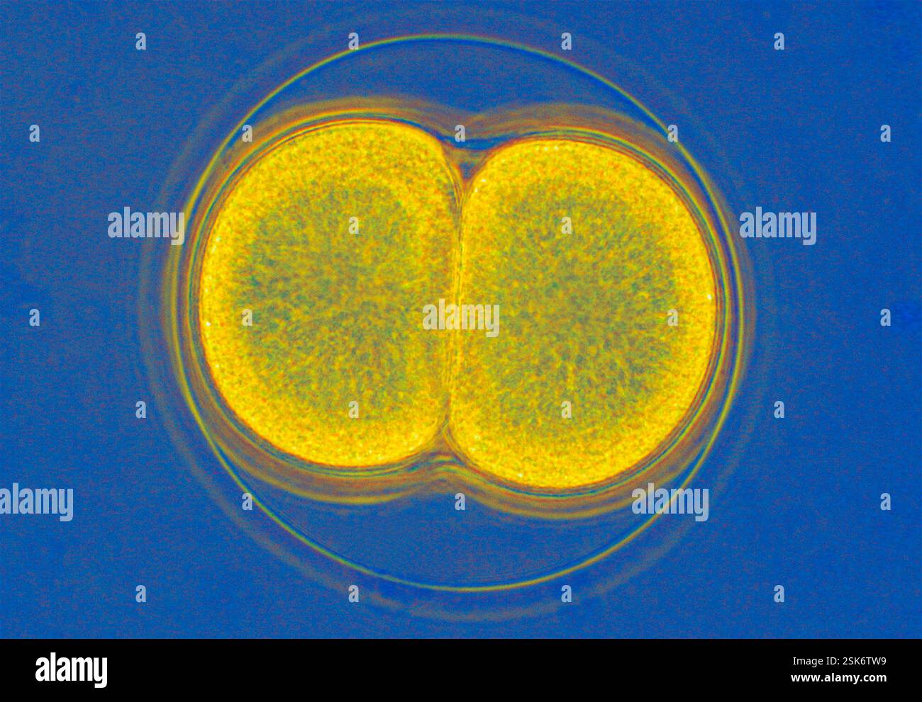 Sea urchin embryo, two-cell stage, light micrograph. This is the stage ...