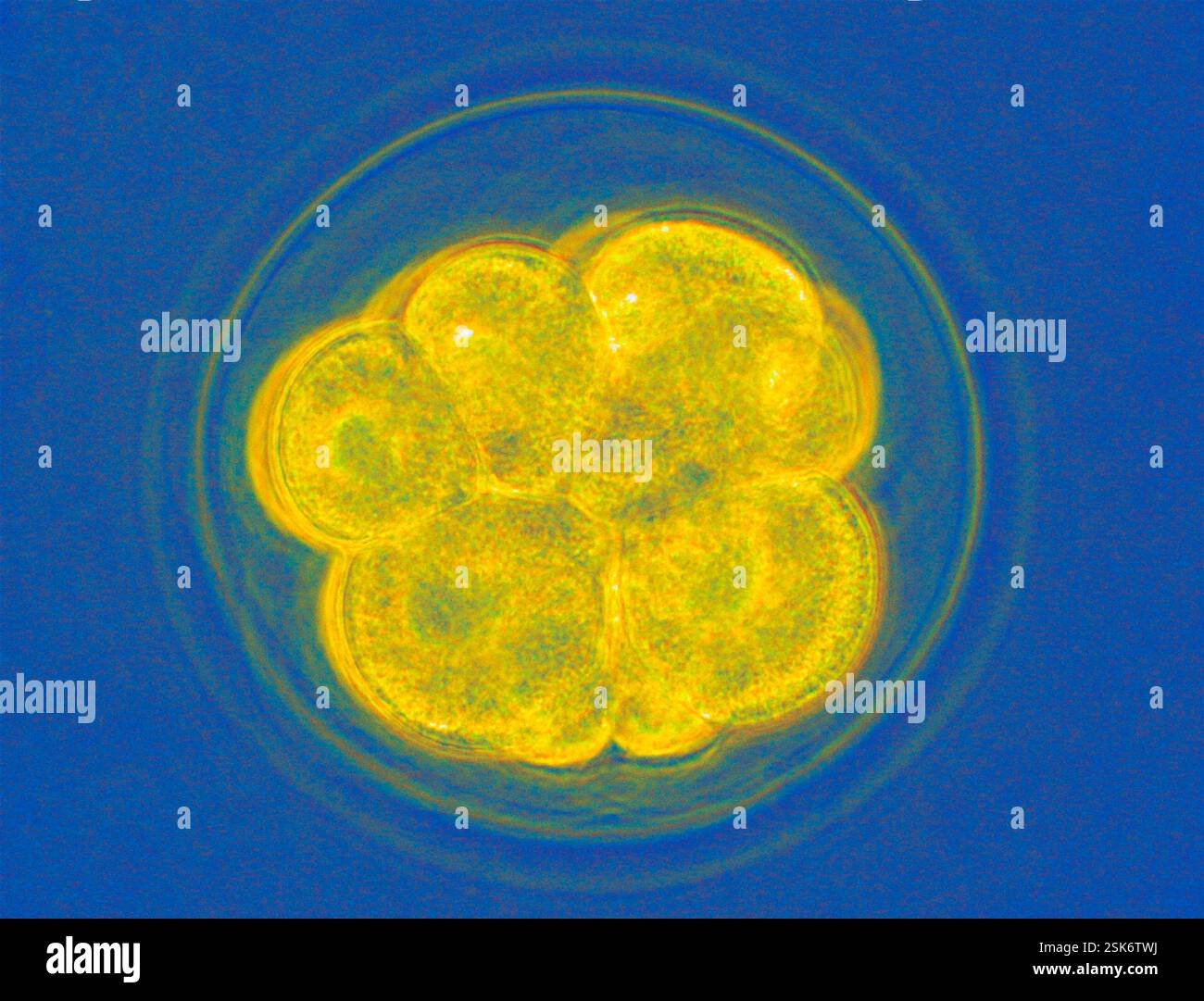 Sea urchin embryo, 16-cell stage, light micrograph. These 16 identical ...