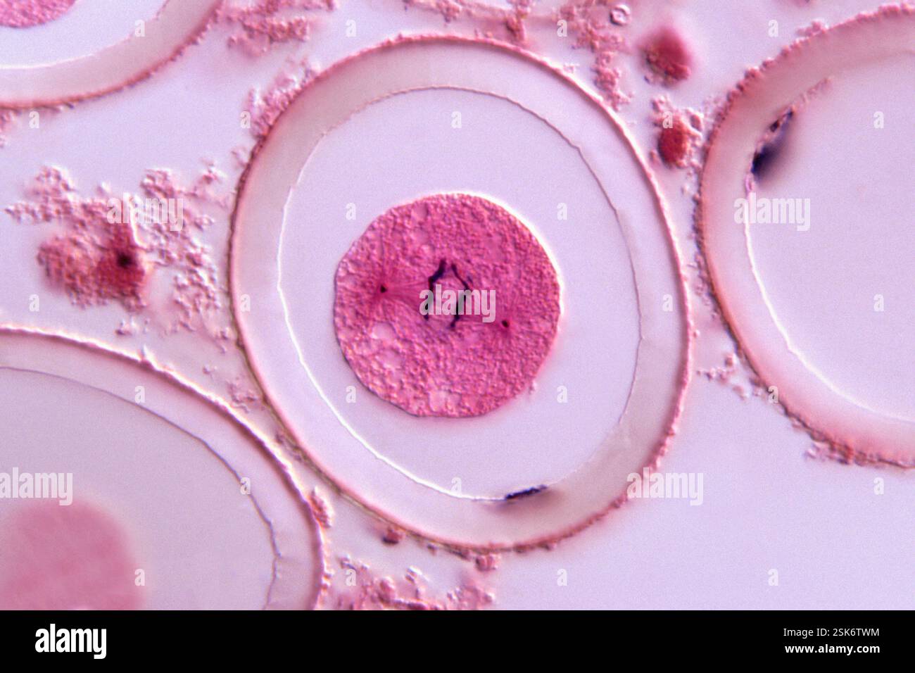Mitosis. Light micrograph of a roundworm (Ascaris sp.) egg cell during ...