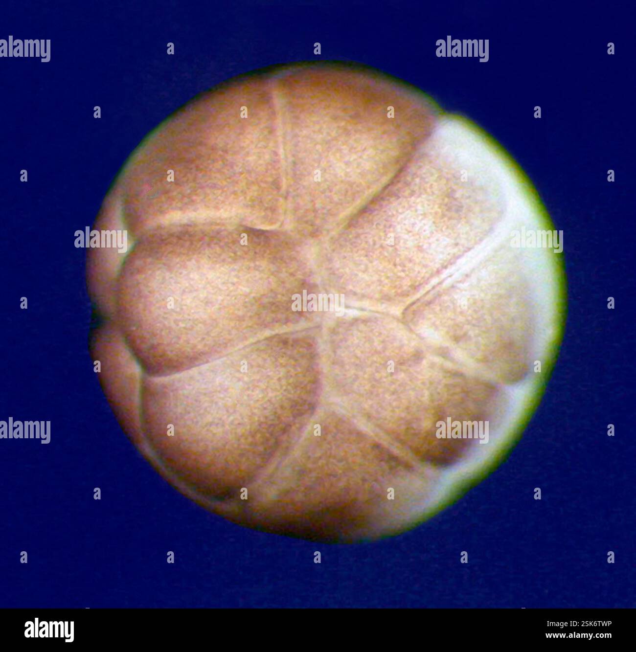 Xenopus laevis embryo, 16-cell stage. Xenopus laevis, the African ...