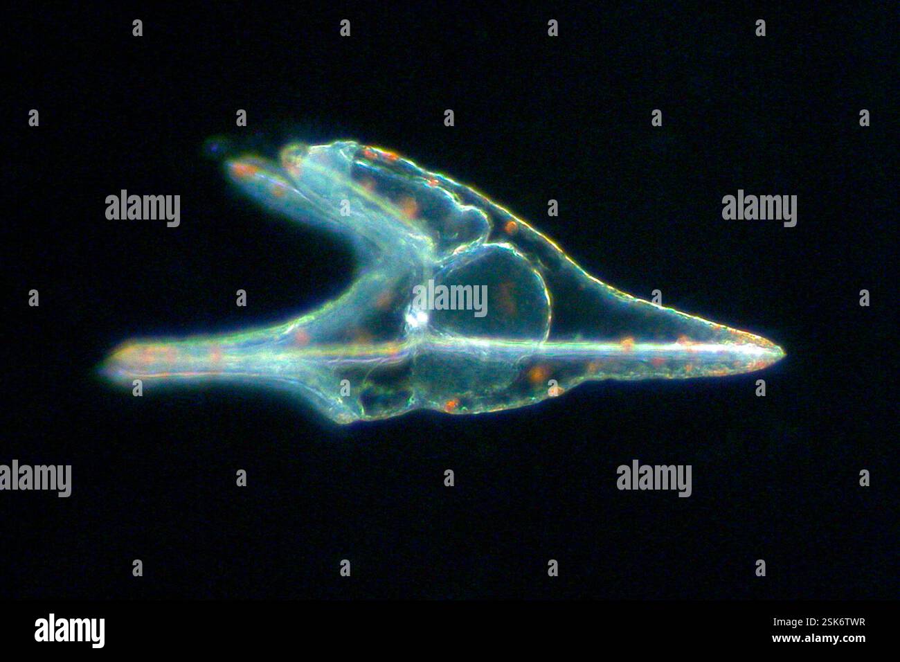 Sea urchin larva, light micrograph. This larval stage is known as a ...