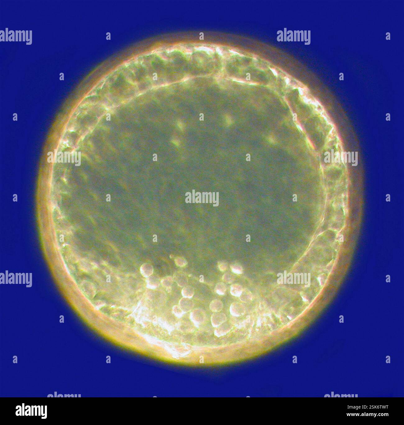 Sea urchin embryo, gastrula stage, light micrograph. In the gastrula ...