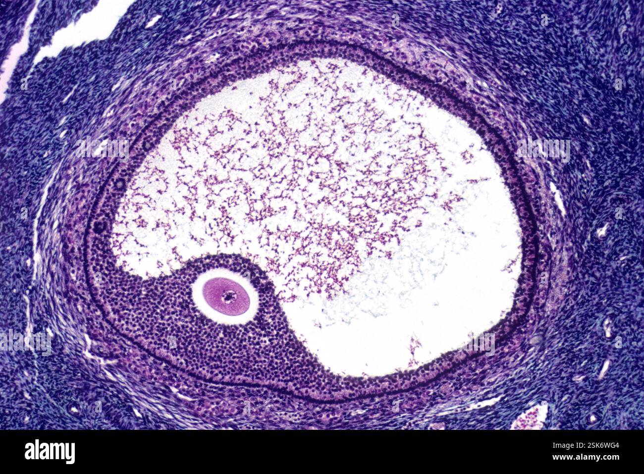 Graafian follicle. Light micrograph of a section through a mature ...