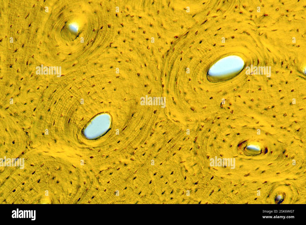 Compact bone, light micrograph Stock Photo - Alamy