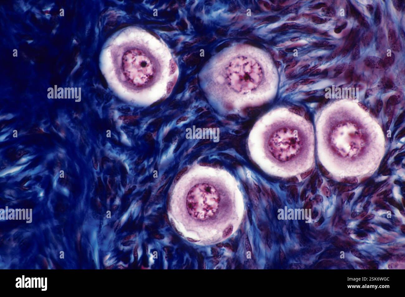 Maturing ovarian follicles. Light micrograph of a section through an ...