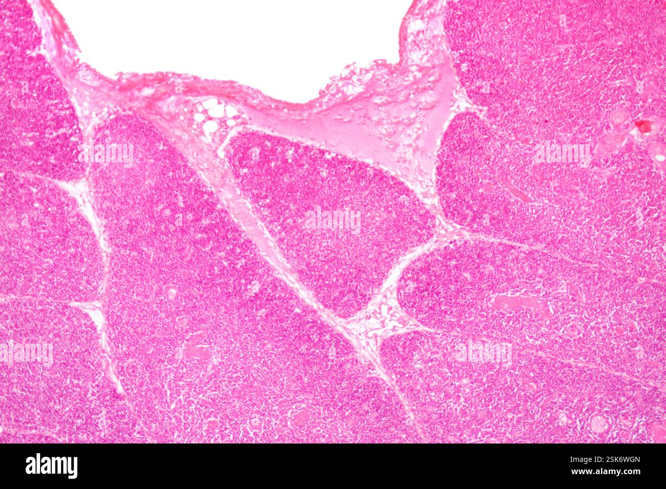 Light micrograph of a section through a young thymus gland showing ...