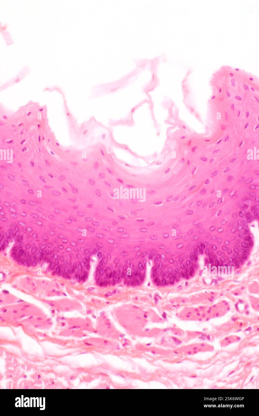 Light micrograph of a section through the wall of the oesophagus. At ...