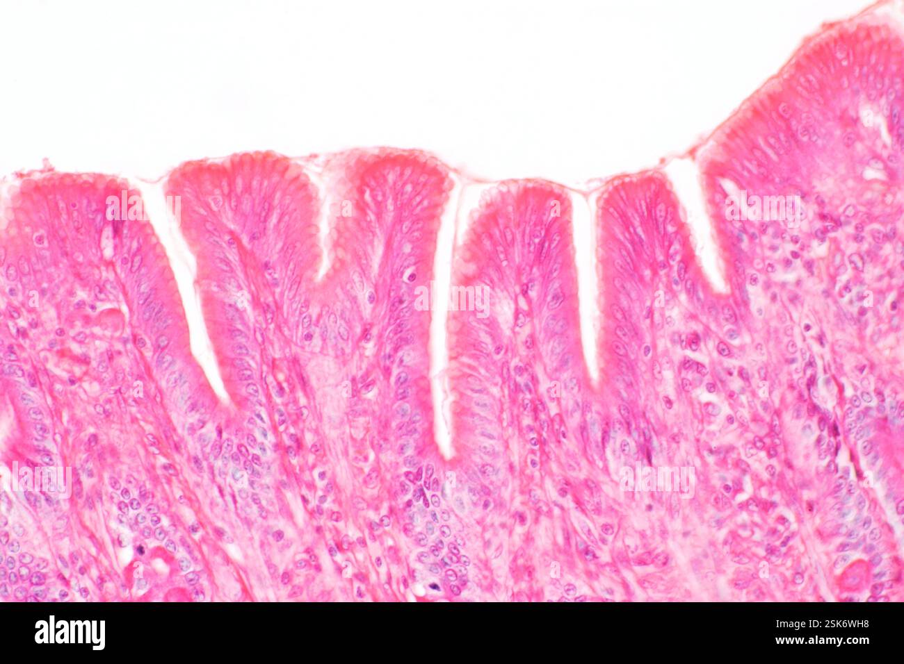 Light micrograph of a section through the wall of the stomach. At top ...