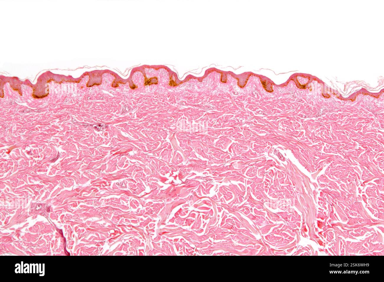 Light micrograph of a skin section in an African (black) person ...
