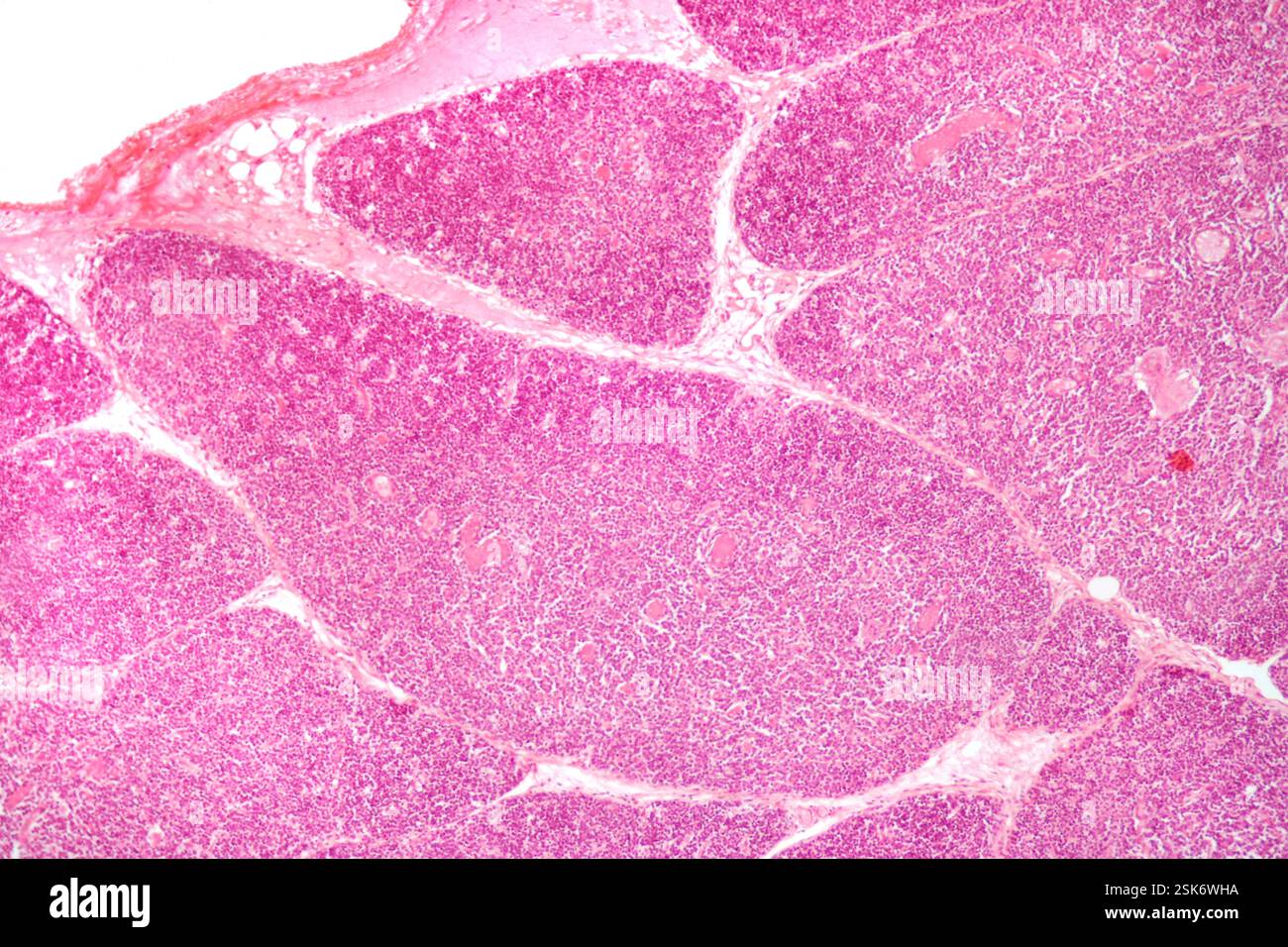 Light micrograph of a section through a young thymus gland showing ...
