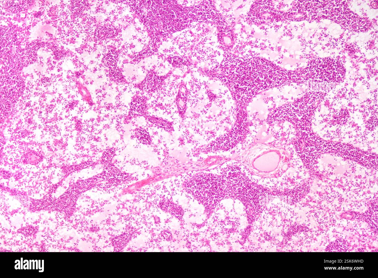 Light micrograph of a section through a lymph node showing medullary ...
