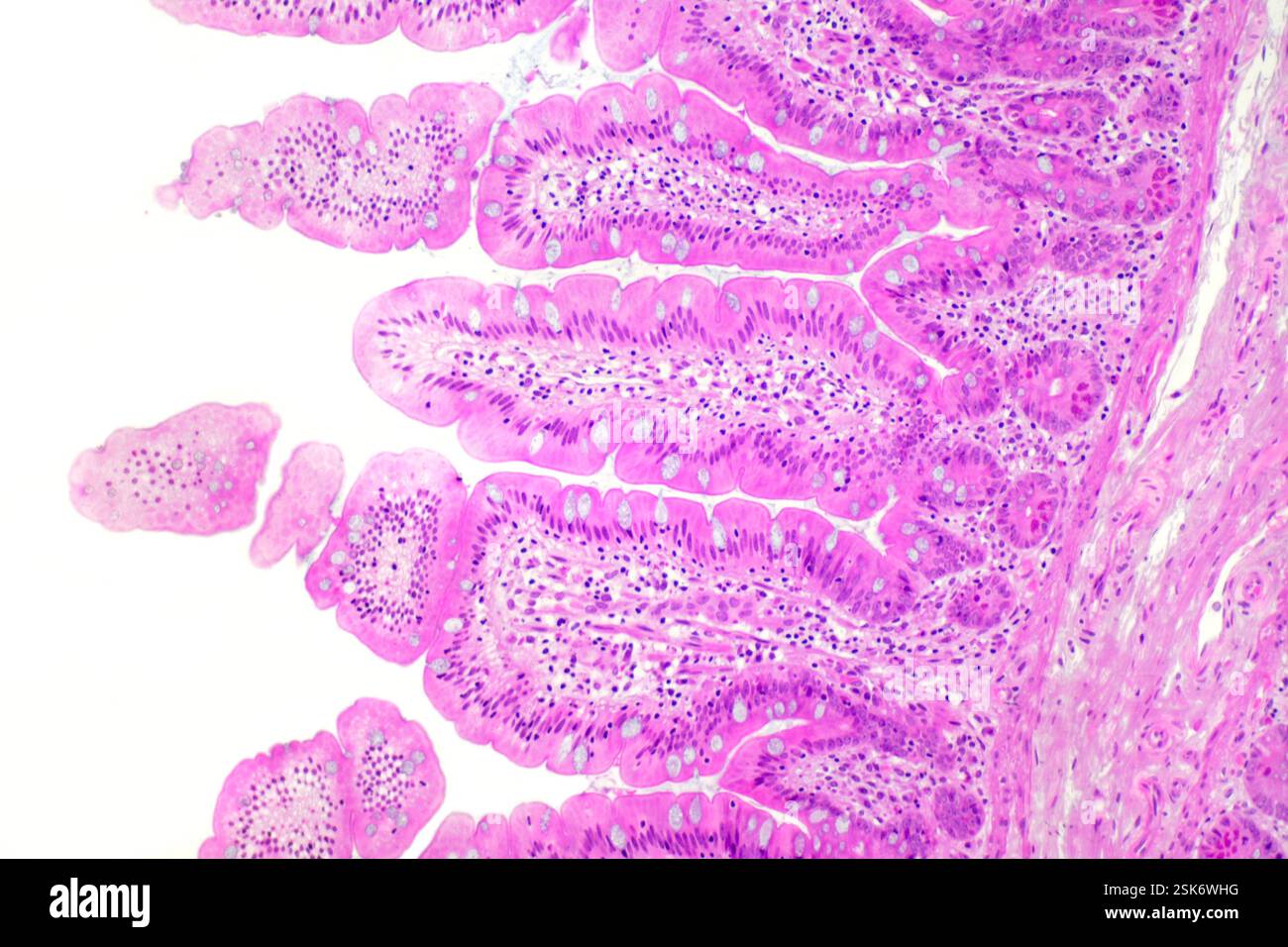 Light micrograph of a section through the wall of the small intestine ...