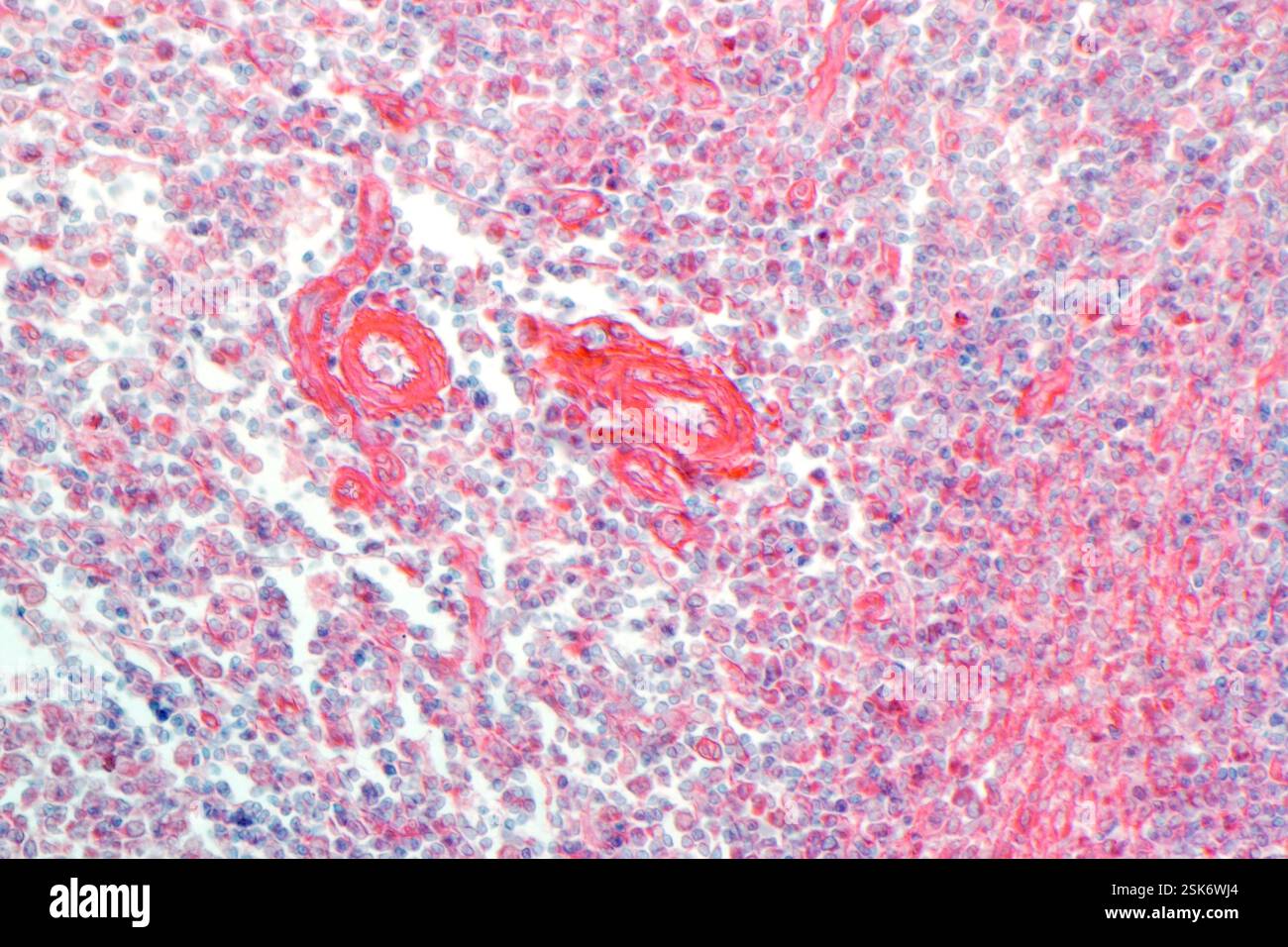 Light micrograph of a section through a young thymus gland showing the ...