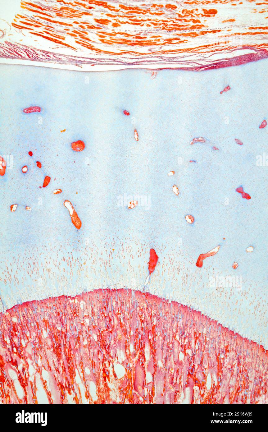 Light micrograph of a longitudinal section through the growing end of a ...