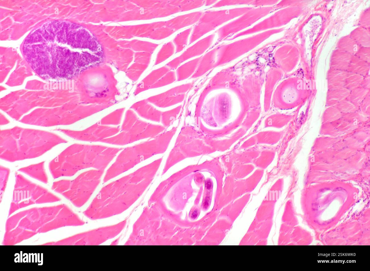 Light micrograph of a section through animal muscle showing an ...