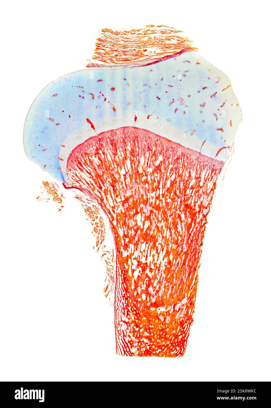 Light micrograph of a longitudinal section through the growing end of a ...