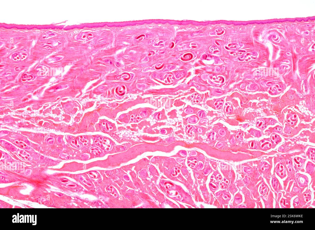 Light micrograph of a section through human muscle showing encysted ...