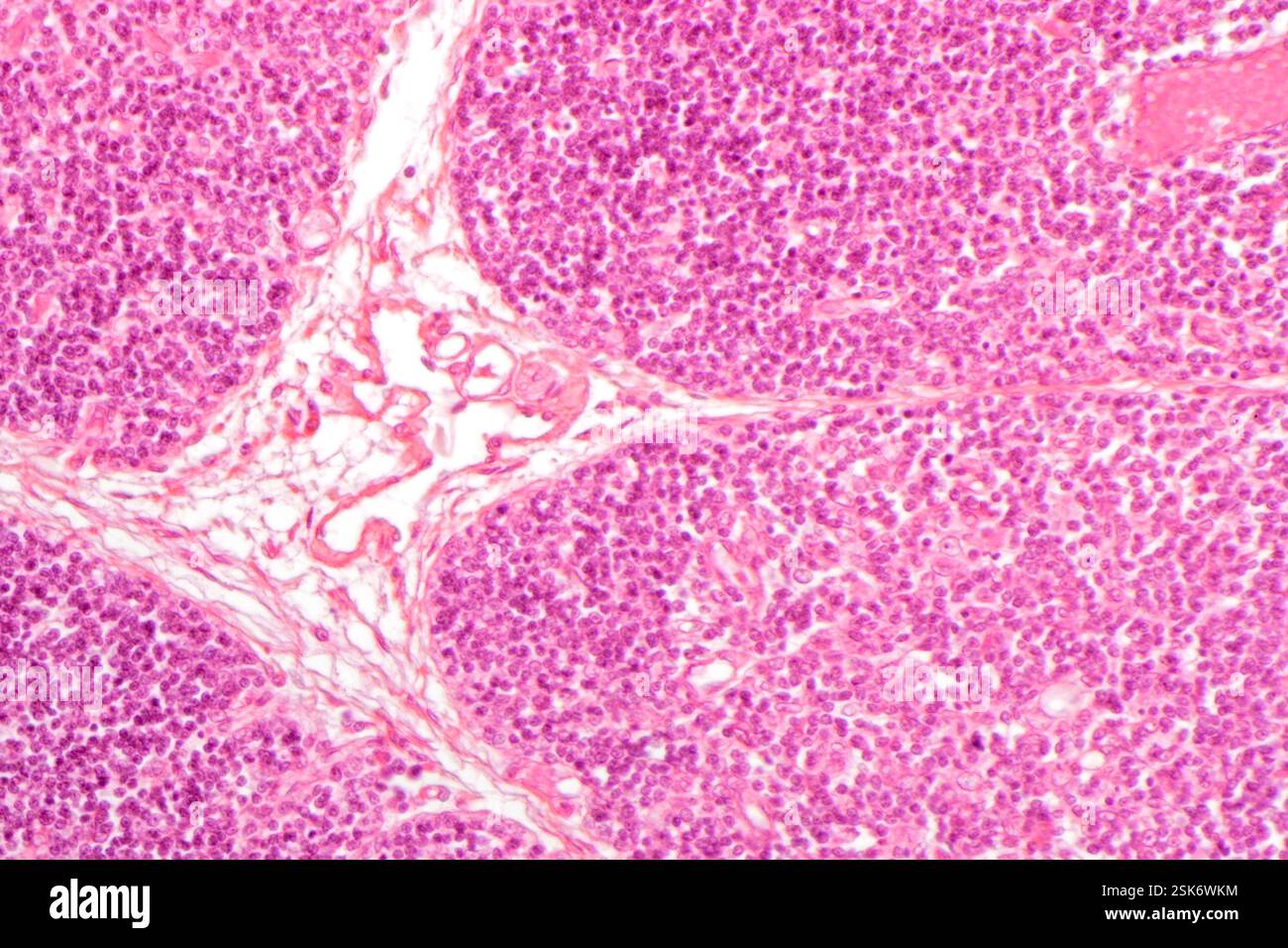 Light micrograph of a section through a young thymus gland showing the ...