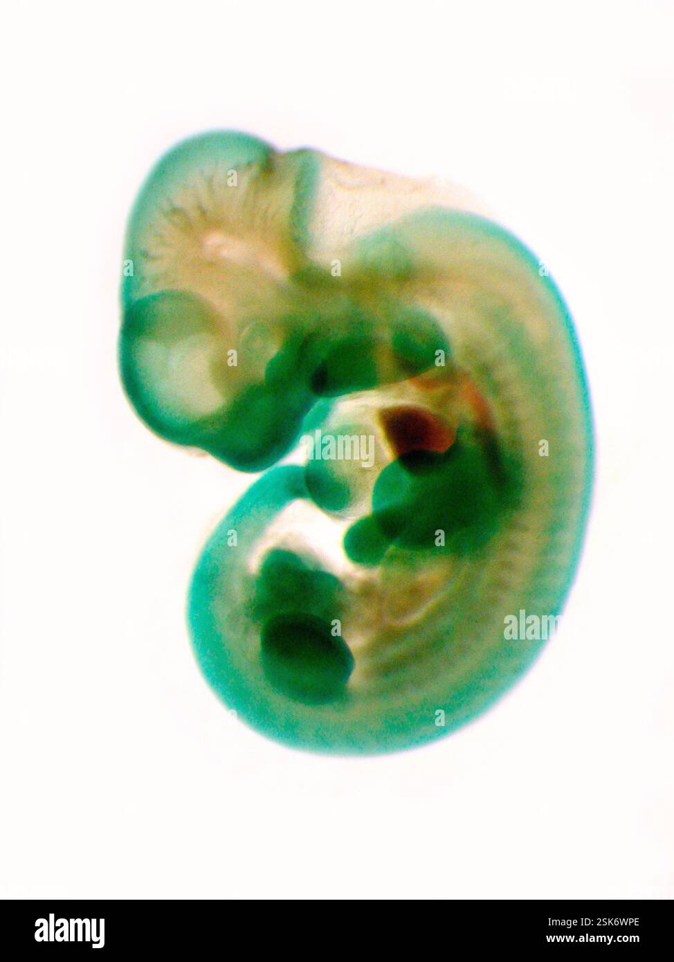 Mouse embryo. Light micrograph of a mouse (Mus sp.) embryo 13 days ...