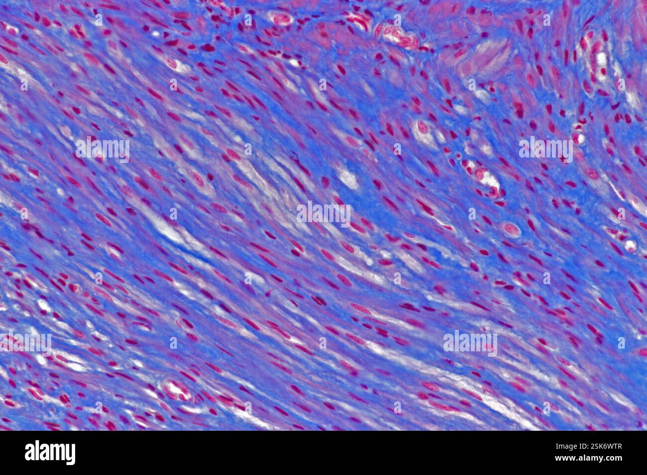 Connective tissue. Light micrograph of a section through connective ...