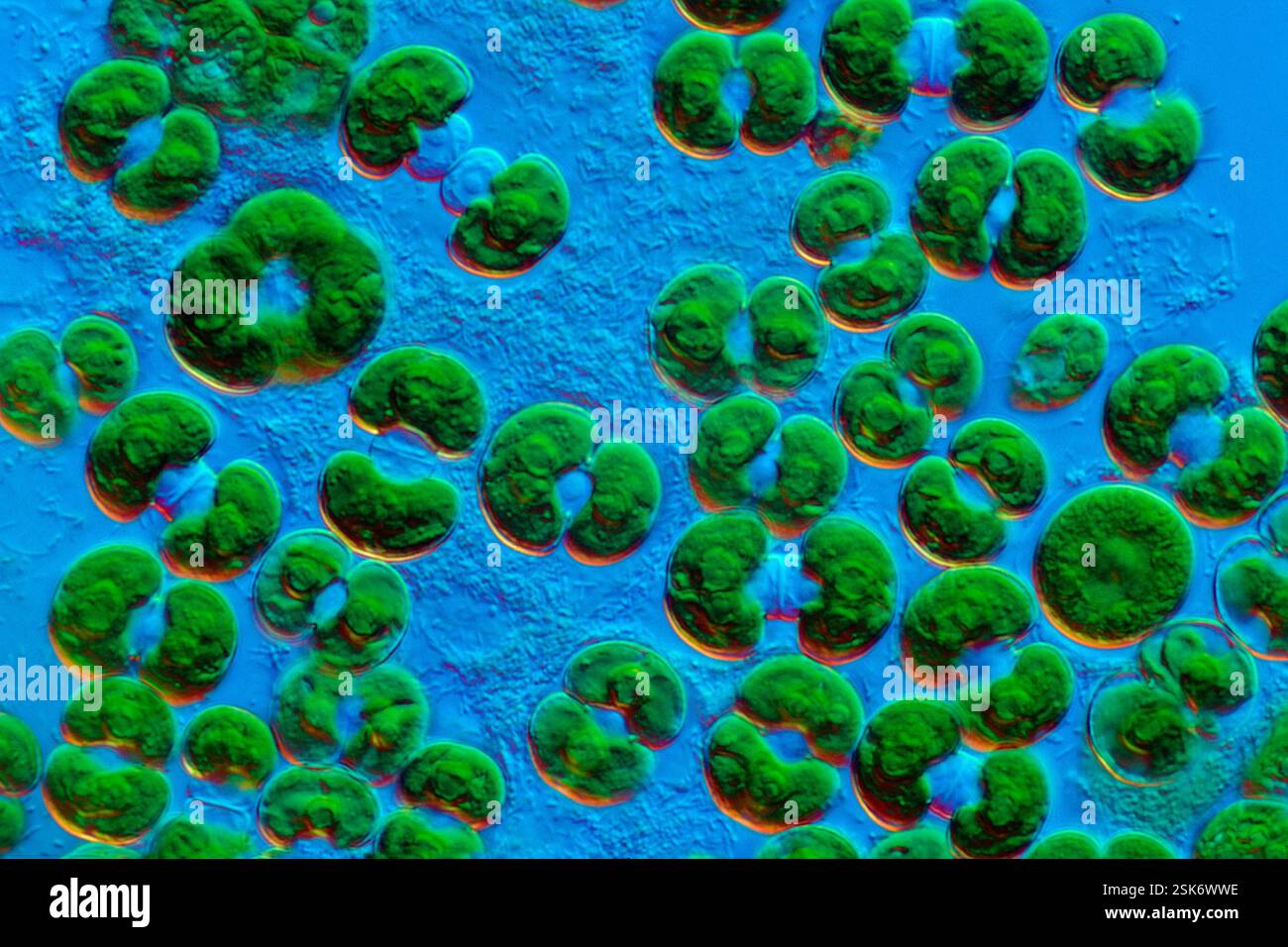 Desmid algae. Light micrograph of Cosmarium sp. microalgae. Cosmarium ...