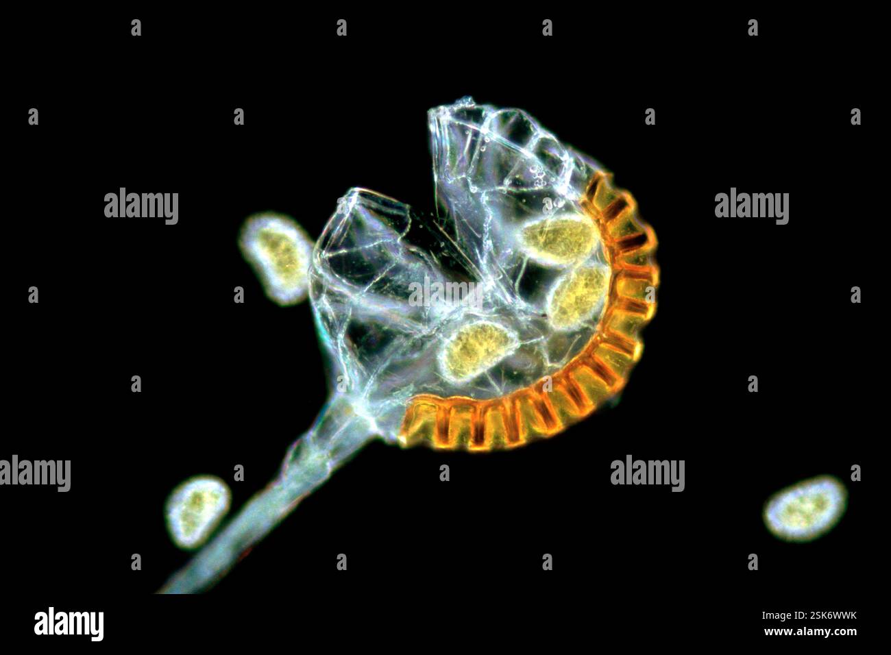 Fern spores. Light micrograph of a single sporangium from a common polypody (Polypodium vulgare ...