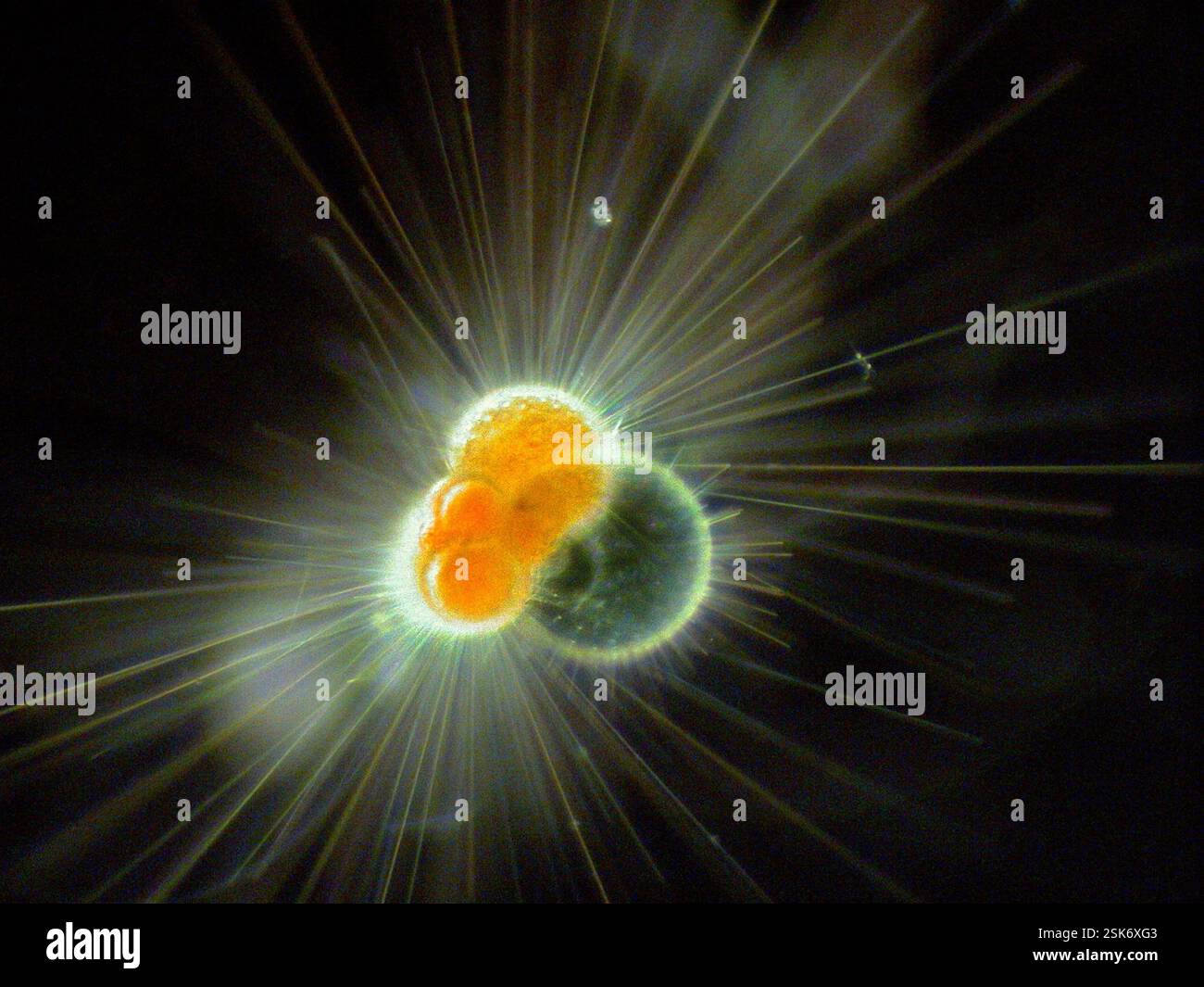 Planktonic foraminiferan. Light micrograph of a Globigerina sp ...