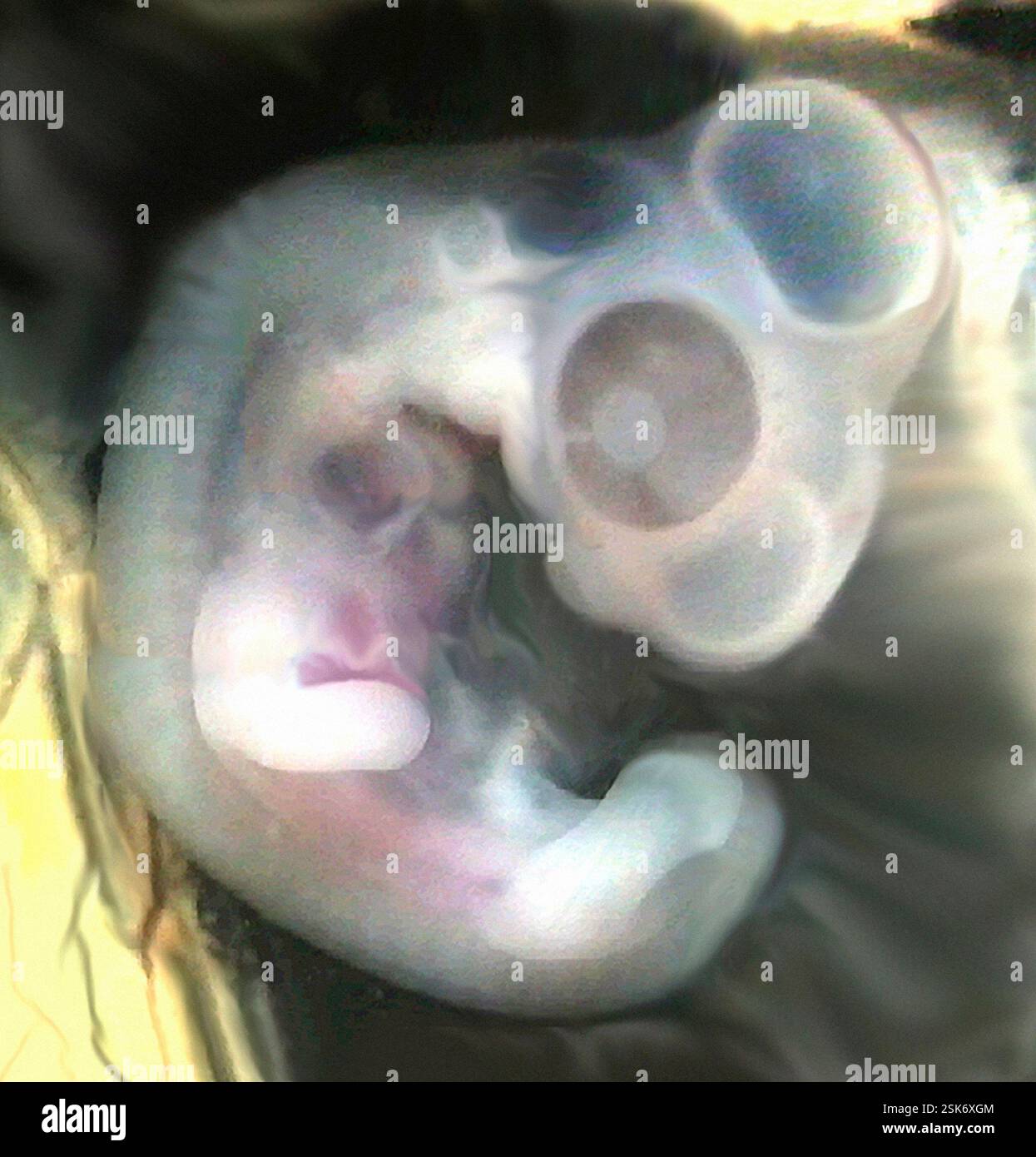 Chicken embryo. Light micrograph of a chicken (Gallus domesticus ...