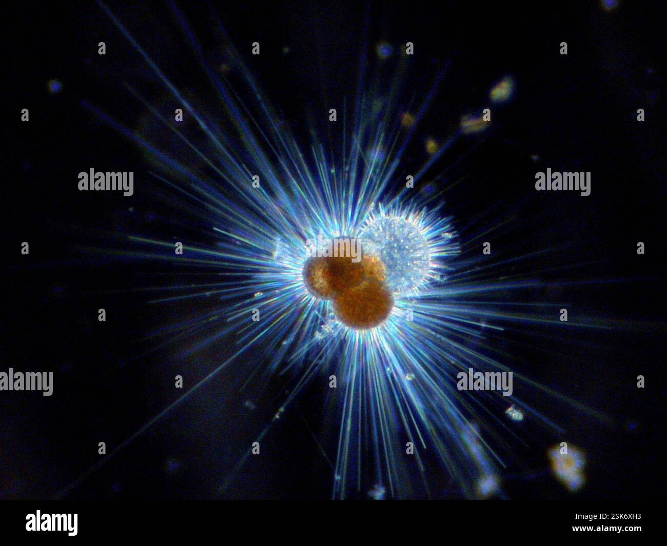 Planktonic foraminiferan. Light micrograph of a Globigerina sp ...