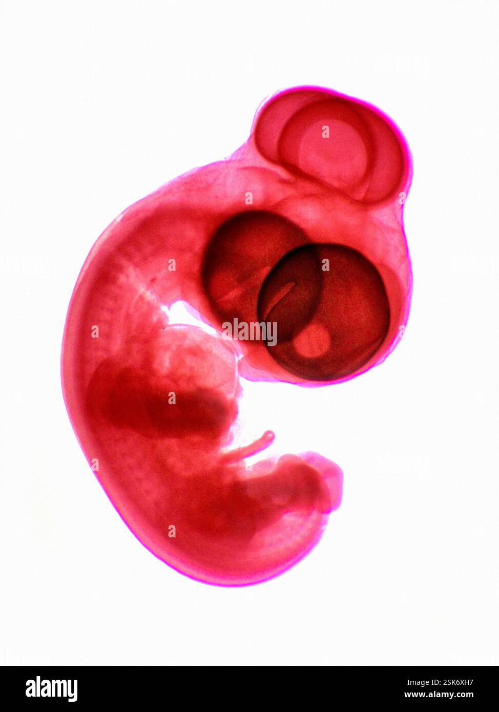 Chicken embryo. Light micrograph of a chicken (Gallus domesticus ...