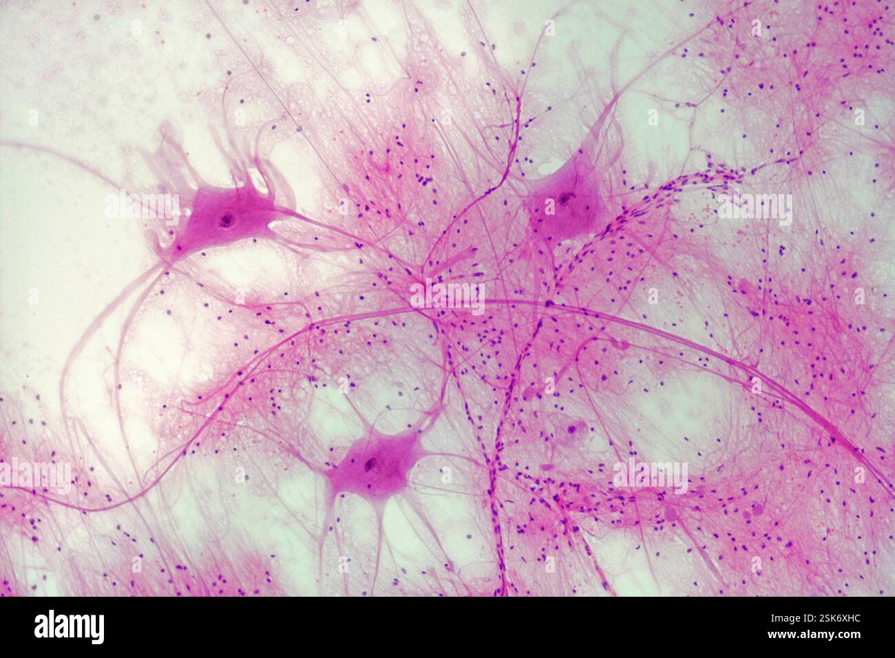 Multipolar neurons. Light micrograph of a cluster of multipolar nerve ...